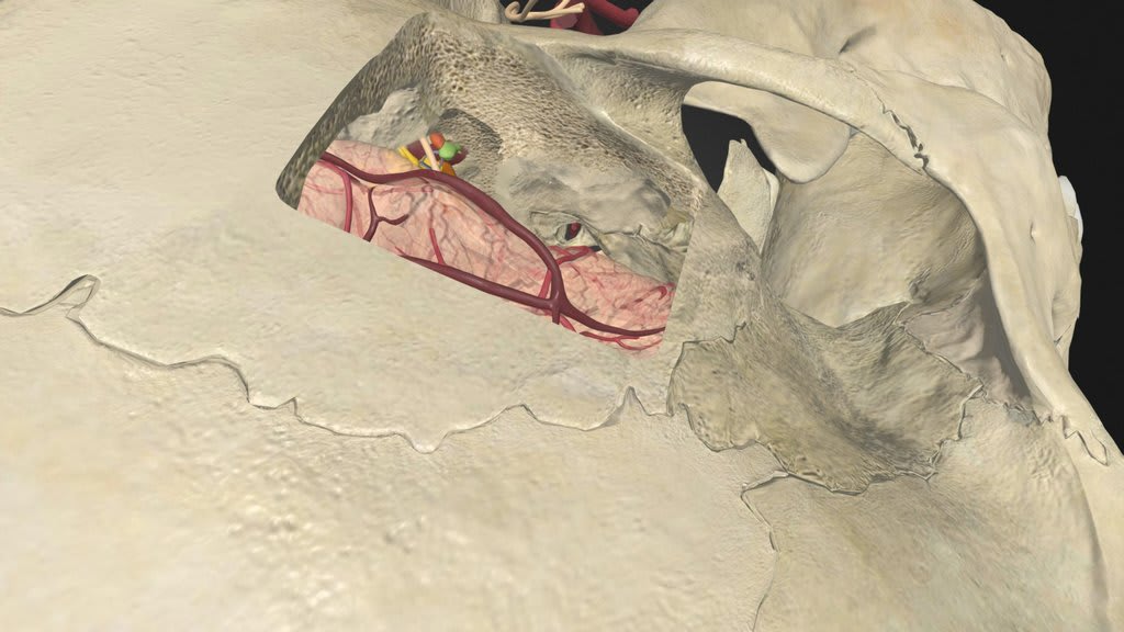 Anterior Petrosectomy | 3D Models | The Neurosurgical Atlas