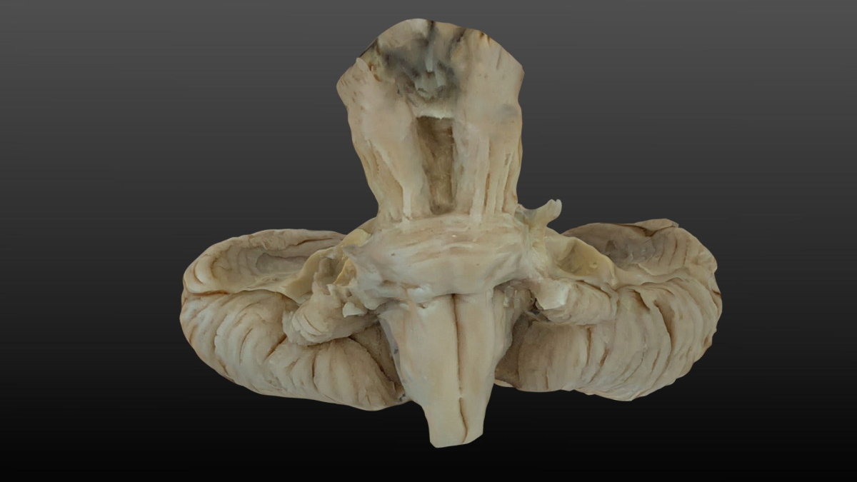 Cerebellum and Brainstem Fig. 1E | 3D Models | The Neurosurgical Atlas