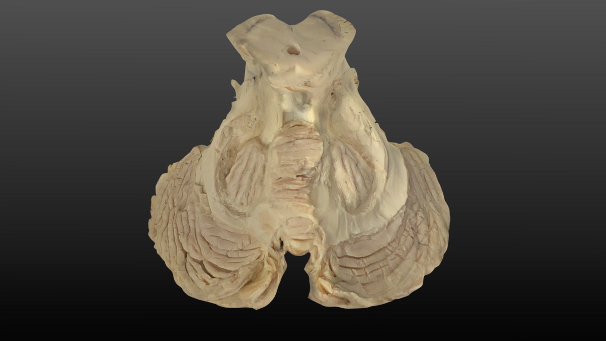Cerebellum and Brainstem Fig. 2K | 3D Models | The Neurosurgical Atlas