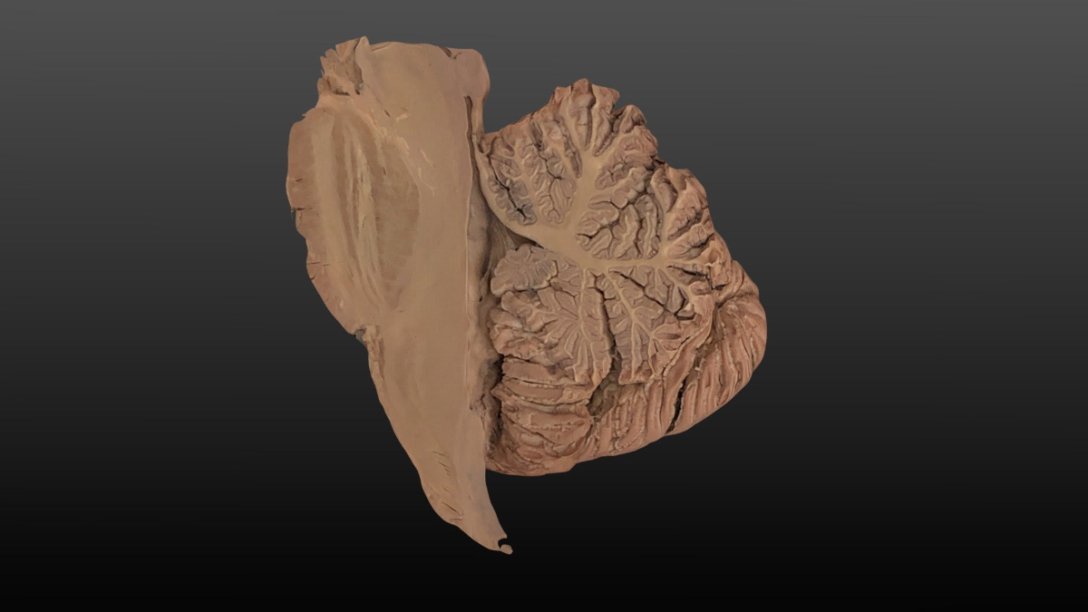 Cerebellum and Brainstem Fig. 3A | 3D Models | The Neurosurgical Atlas