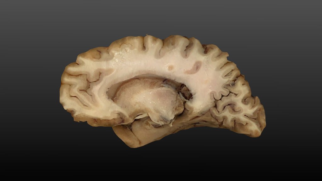 Cerebrum 2G | 3D Models | The Neurosurgical Atlas