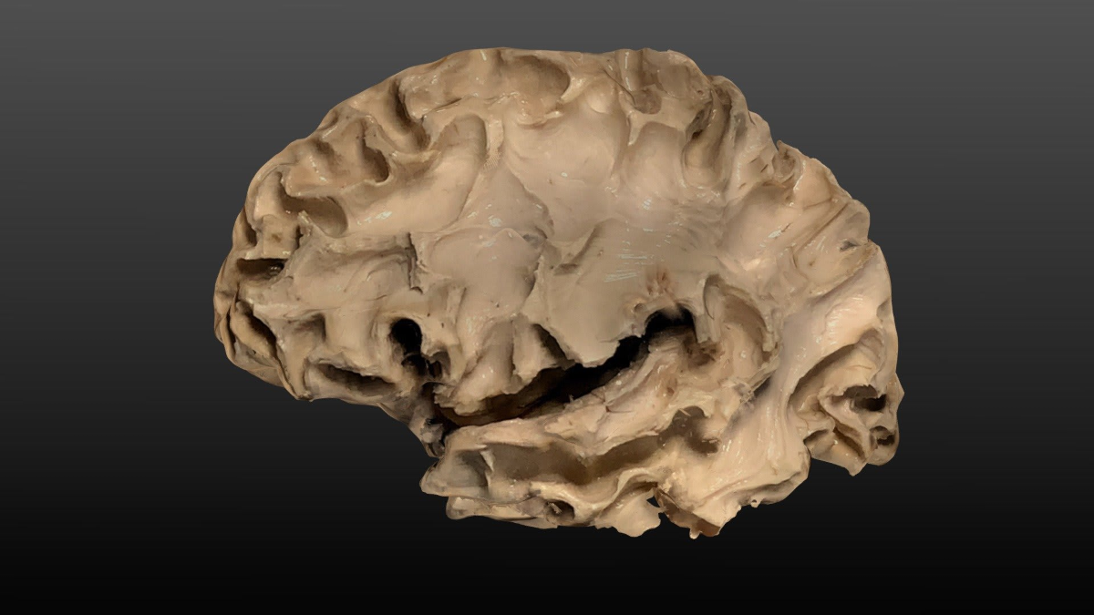 Cerebrum Fig. 3A | 3D Models | The Neurosurgical Atlas