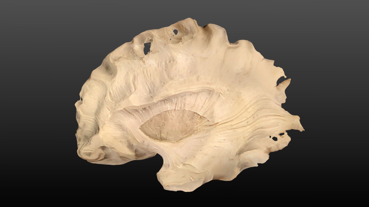Cerebrum Fig. 3M, 3O | 3D Models | The Neurosurgical Atlas