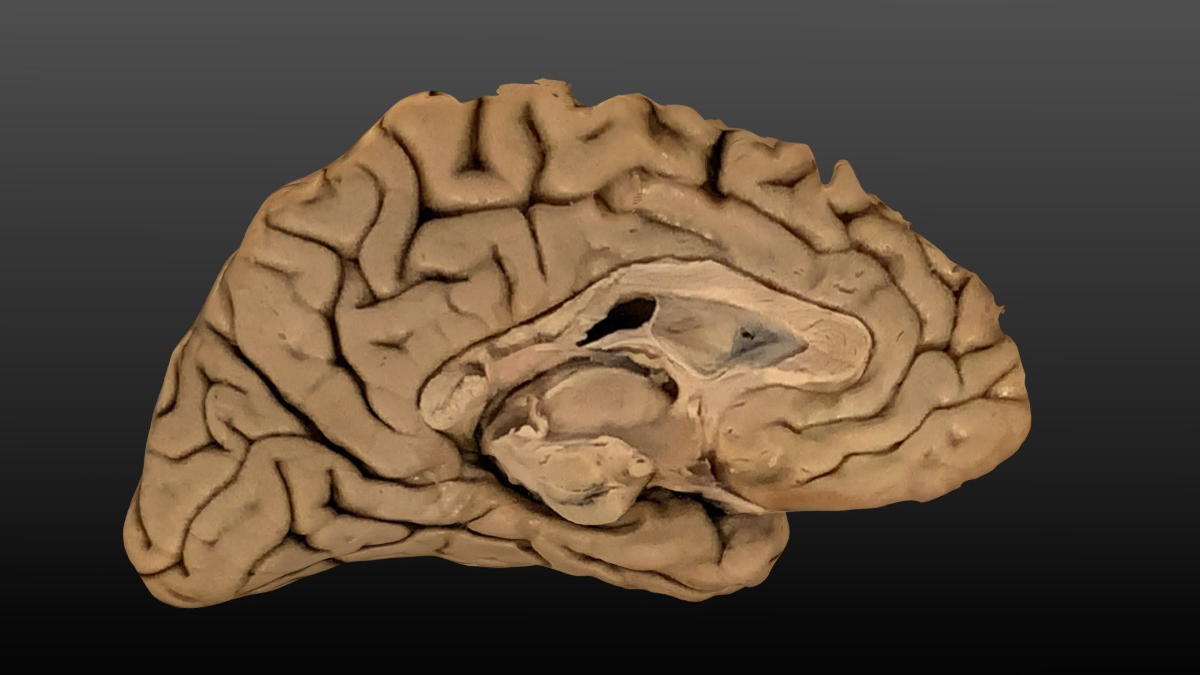 Cerebrum Fig. 4C | 3D Models | The Neurosurgical Atlas