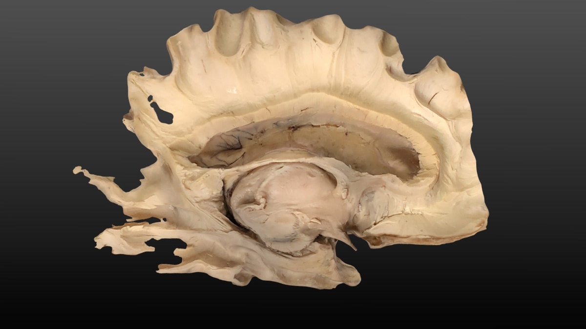 Cerebrum Fig. 4K | 3D Models | The Neurosurgical Atlas