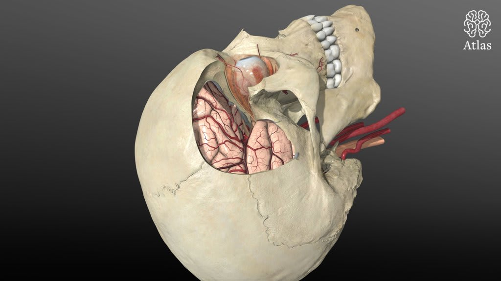Orbitozygomatic Craniotomy | 3D Models | The Neurosurgical Atlas