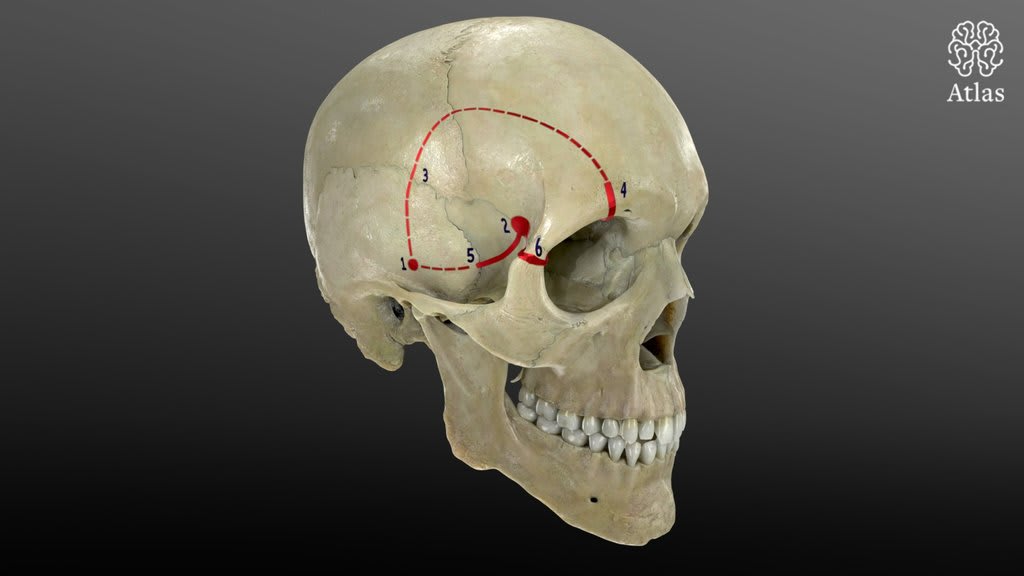 Orbitozygomatic: Outline of Osteotomy | 3D Models | The Neurosurgical Atlas