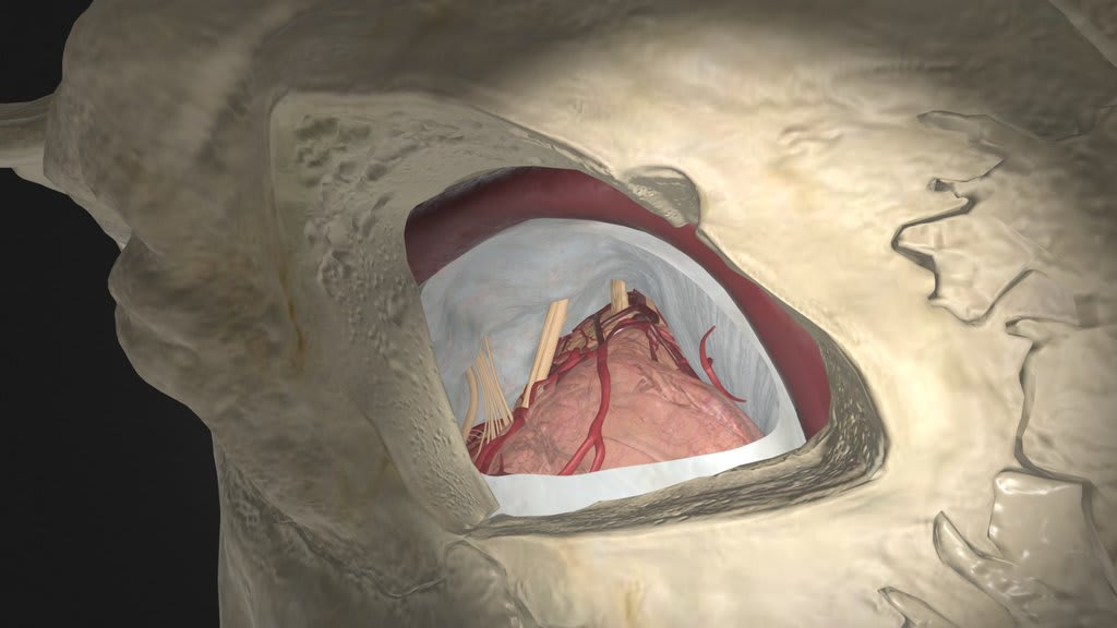 Retrosigmoid Approach | 3D Models | The Neurosurgical Atlas