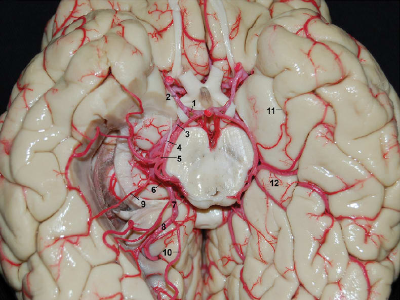 Another View of the Basal Surfaces of the Brain | Neuroanatomy | The ...