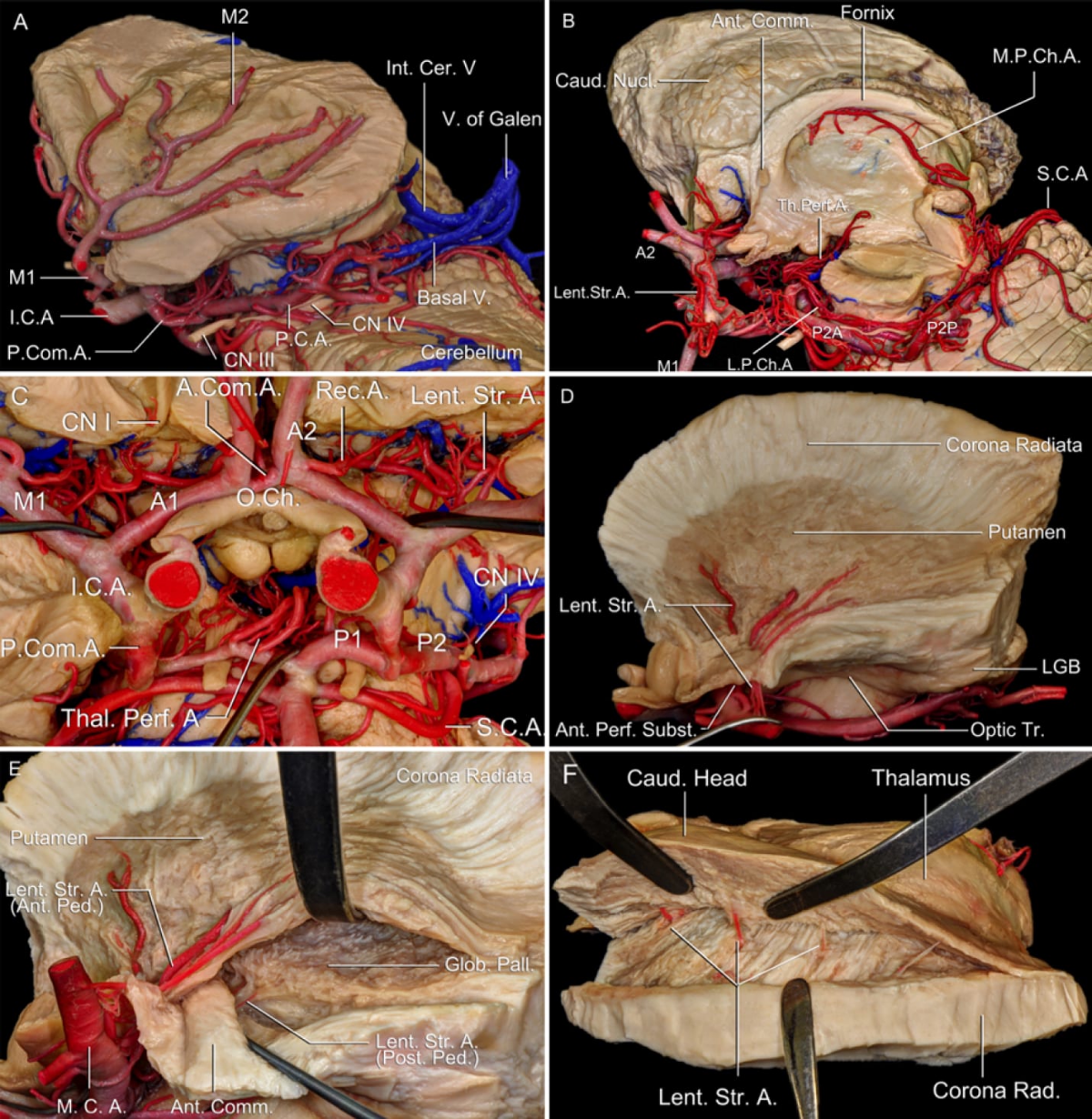 Arterial Supply of the Central Core | Neuroanatomy | The Neurosurgical ...