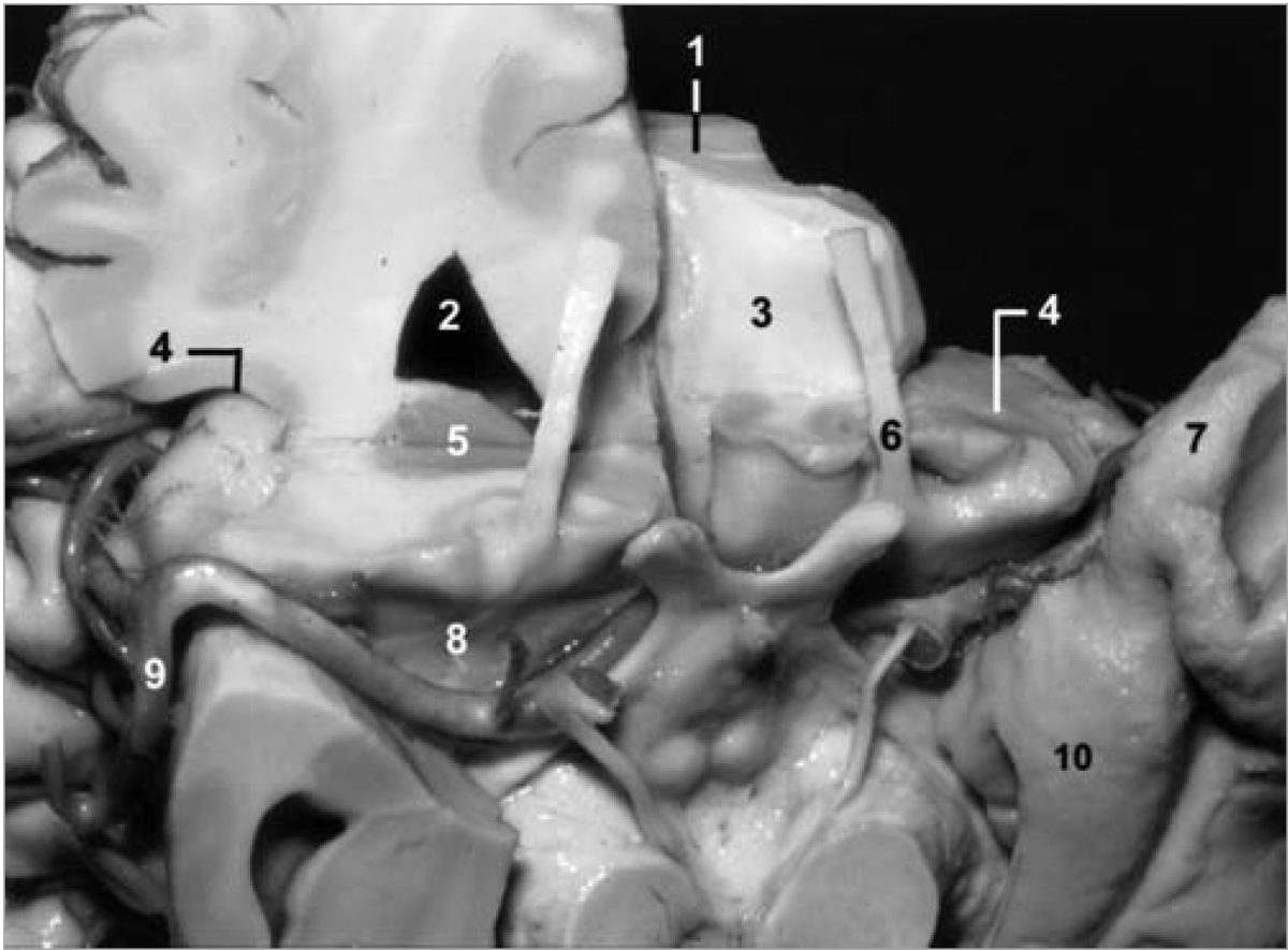 Basal View of the Frontal Lobe | Neuroanatomy | The Neurosurgical Atlas