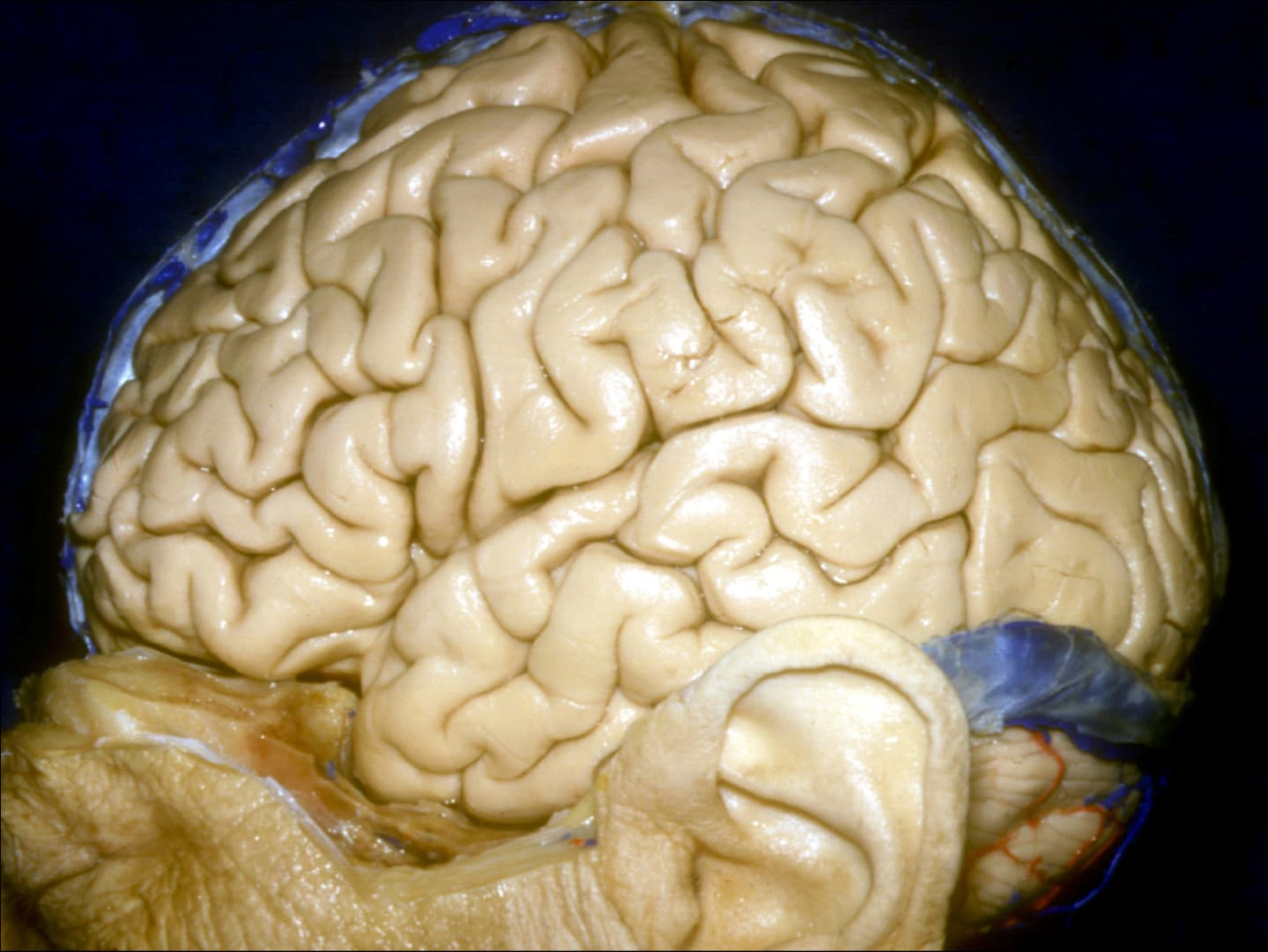 Cerebral Convexity Landmarks | Neuroanatomy | The Neurosurgical Atlas