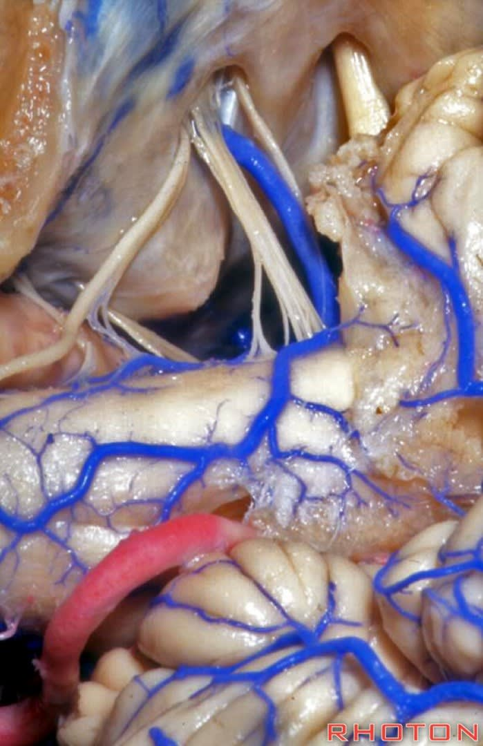 Endocranial Views of the Left Internal Auditory Meatus and Jugular ...