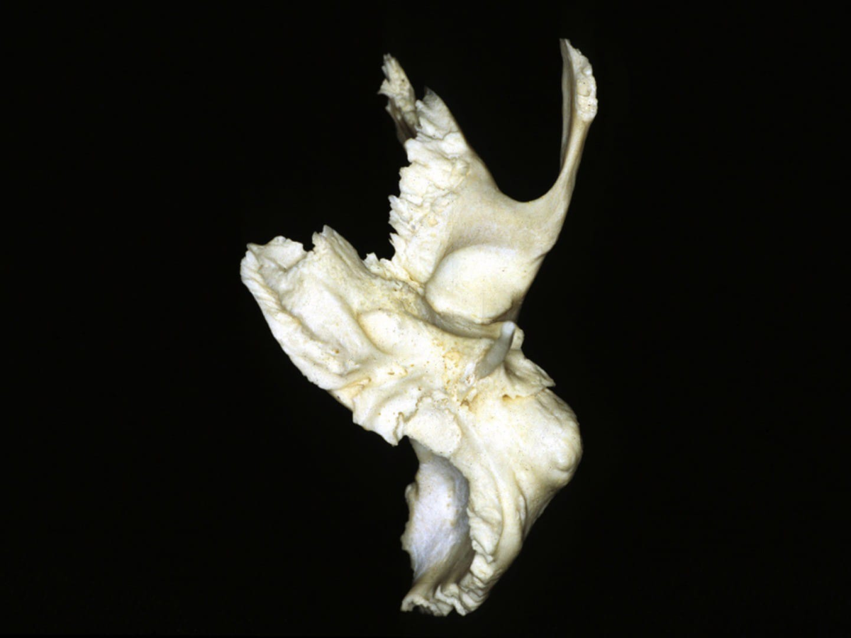 Inferior View of Left Temporal Bone | Neuroanatomy | The Neurosurgical ...