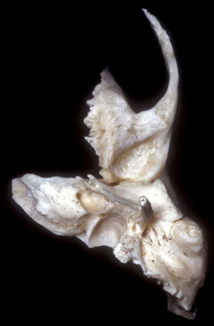 Inferior View of Left Temporal Bone | Neuroanatomy | The Neurosurgical ...