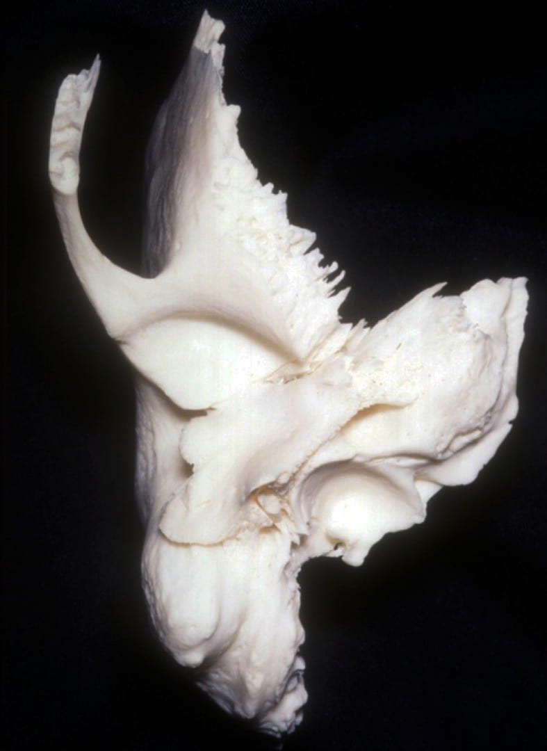 Inferior View of Right Temporal Bone | Neuroanatomy | The Neurosurgical ...