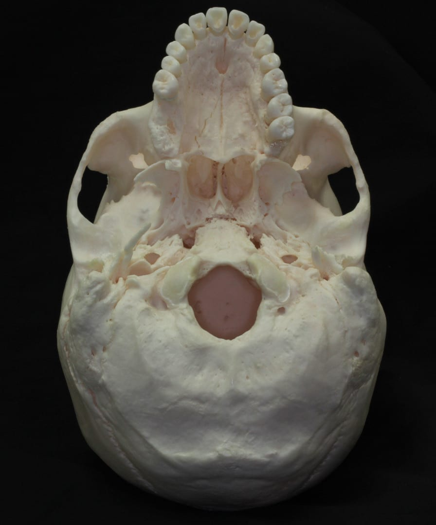 Inferior View of the Base of the Skull | Neuroanatomy | The ...