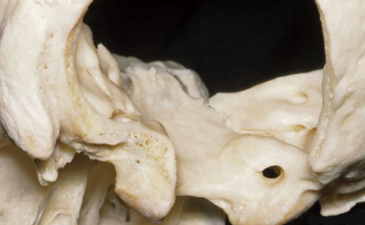 Inferior View of the Clivus Through the Foramen Magnum | Neuroanatomy ...