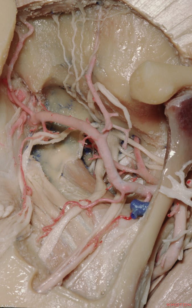 Lateral View of Left Infratemporal Fossa | Neuroanatomy | The ...