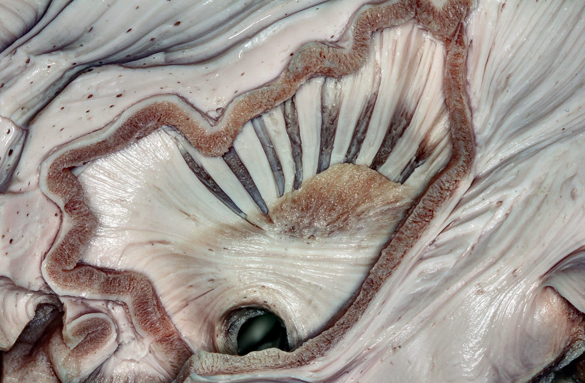 Lateral View of the Deep Insular Region | Neuroanatomy | The ...