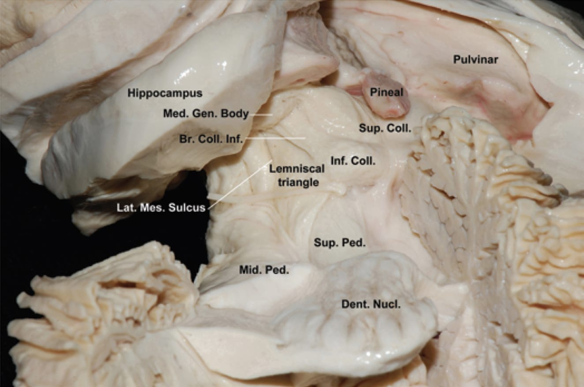 Lateral View of the Midbrain | Neuroanatomy | The Neurosurgical Atlas