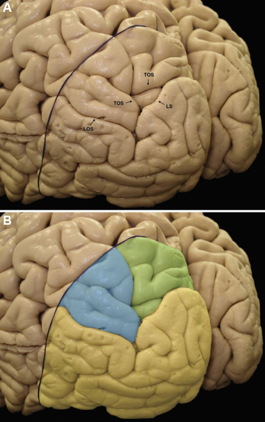 Left Occipital Lobe Convexity | Neuroanatomy | The Neurosurgical Atlas