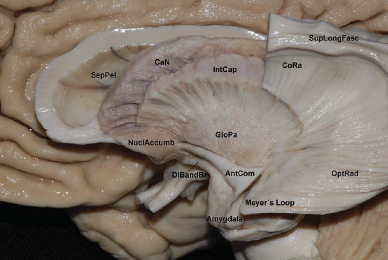 Magnified Lateral View of Left Hemisphere | Neuroanatomy | The ...