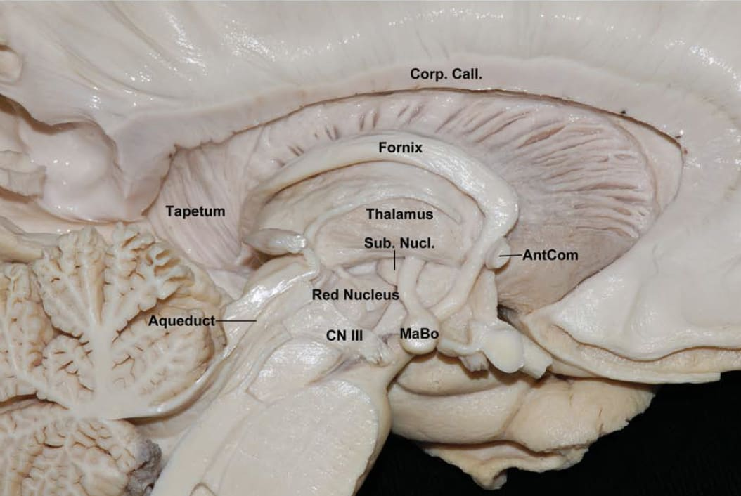 Medial View of the Left Hemisphere | Neuroanatomy | The Neurosurgical Atlas