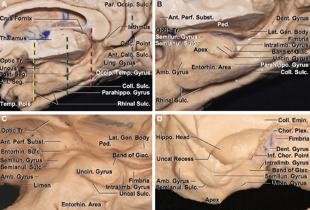 Neural Features and Subdivision of the Medial Temporal Region ...