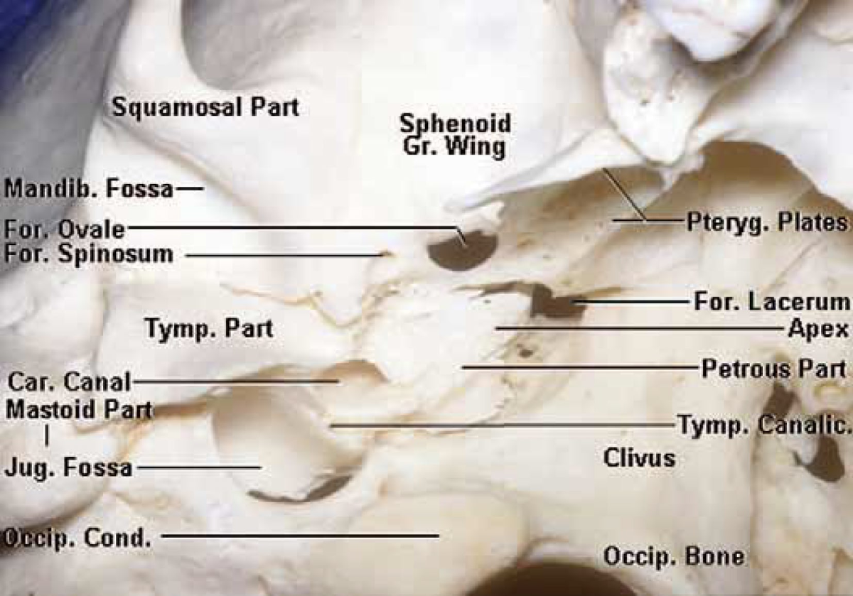Oblique Enlarged Inferior View of the Right Temporal, Sphenoid, and ...