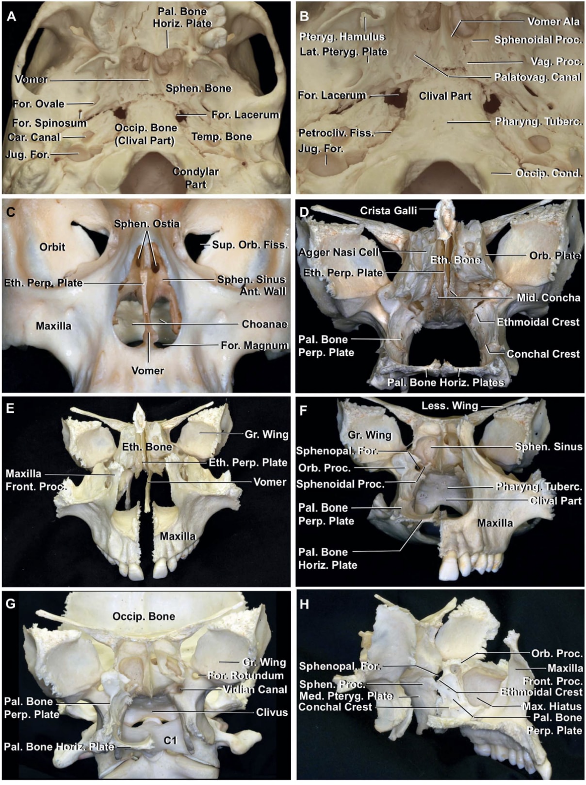 Osseous Relationships of the Exocranial Surface of the Clivus and the ...