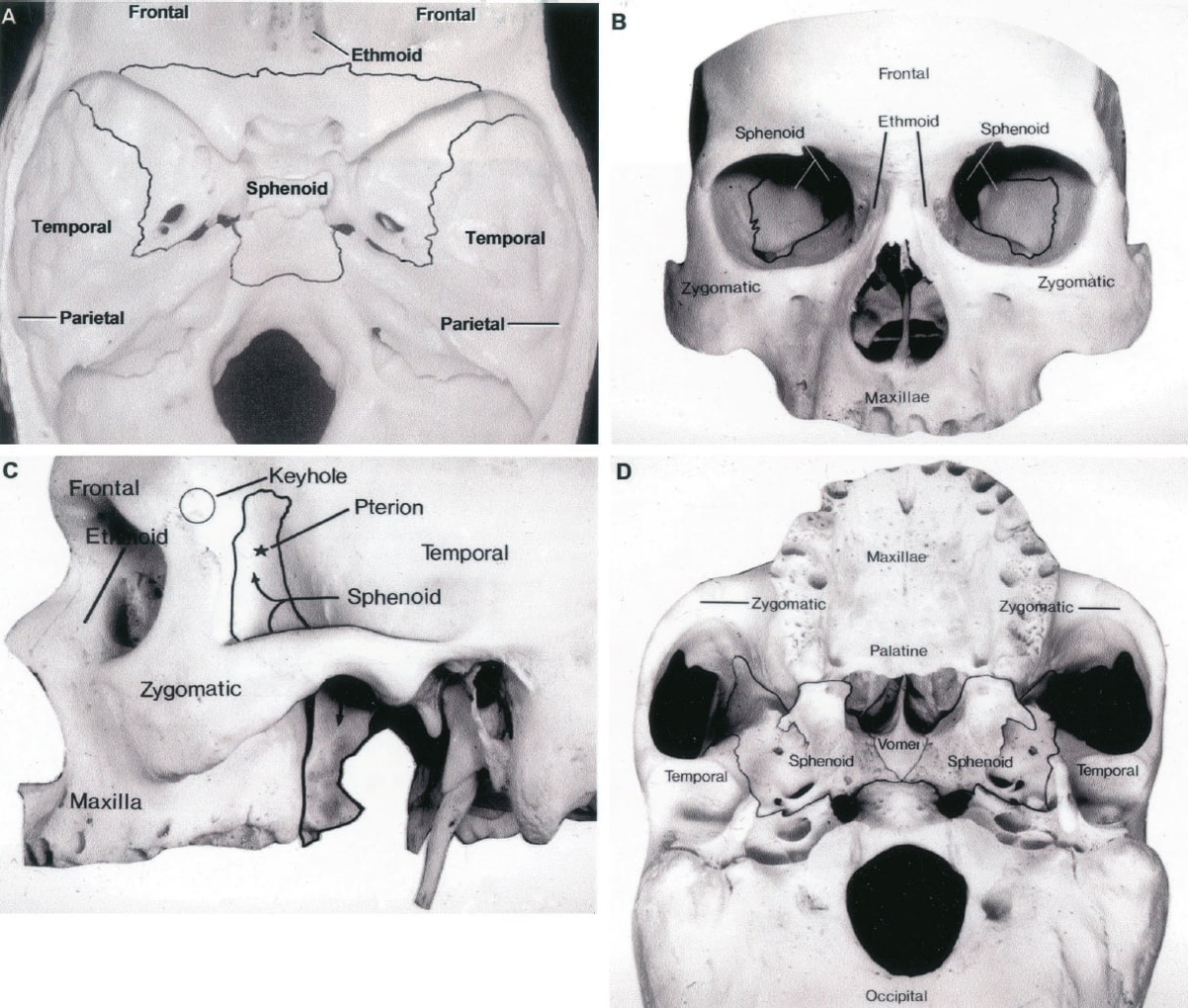Osseous Relationships of the Sphenoid Bone | Neuroanatomy | The ...