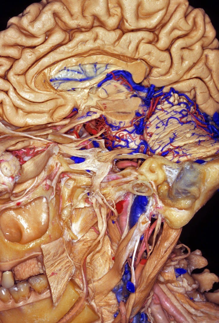 Parasagittal View of Brain and Lateral Head | Neuroanatomy | The ...