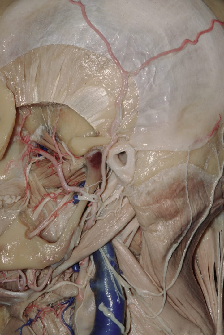 Perspective View of Left Lateral Neck | Neuroanatomy | The ...