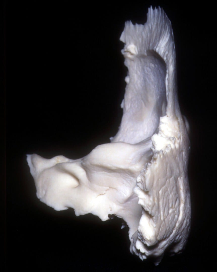 Posterior View of Right Temporal Bone | Neuroanatomy | The ...