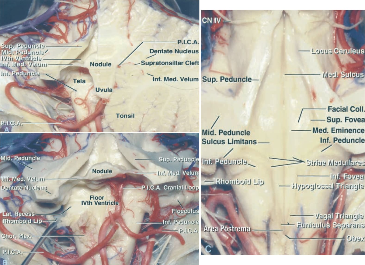 Posterior Views of the Roof of the Fourth Ventricle | Neuroanatomy ...