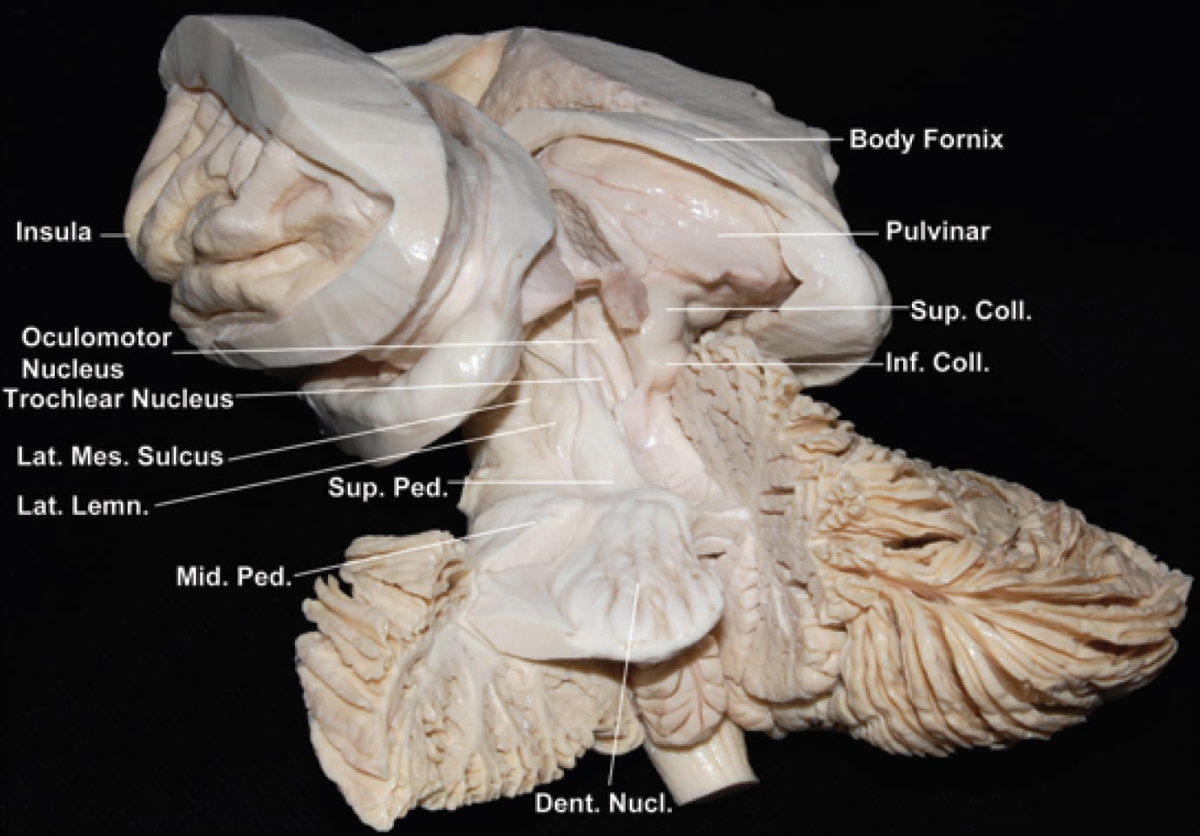 Posterolateral View of the Brainstem and the Central Core of the Brain ...