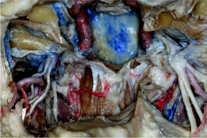 Regional Soft Tissue Anatomy of the Clivus | Neuroanatomy | The ...