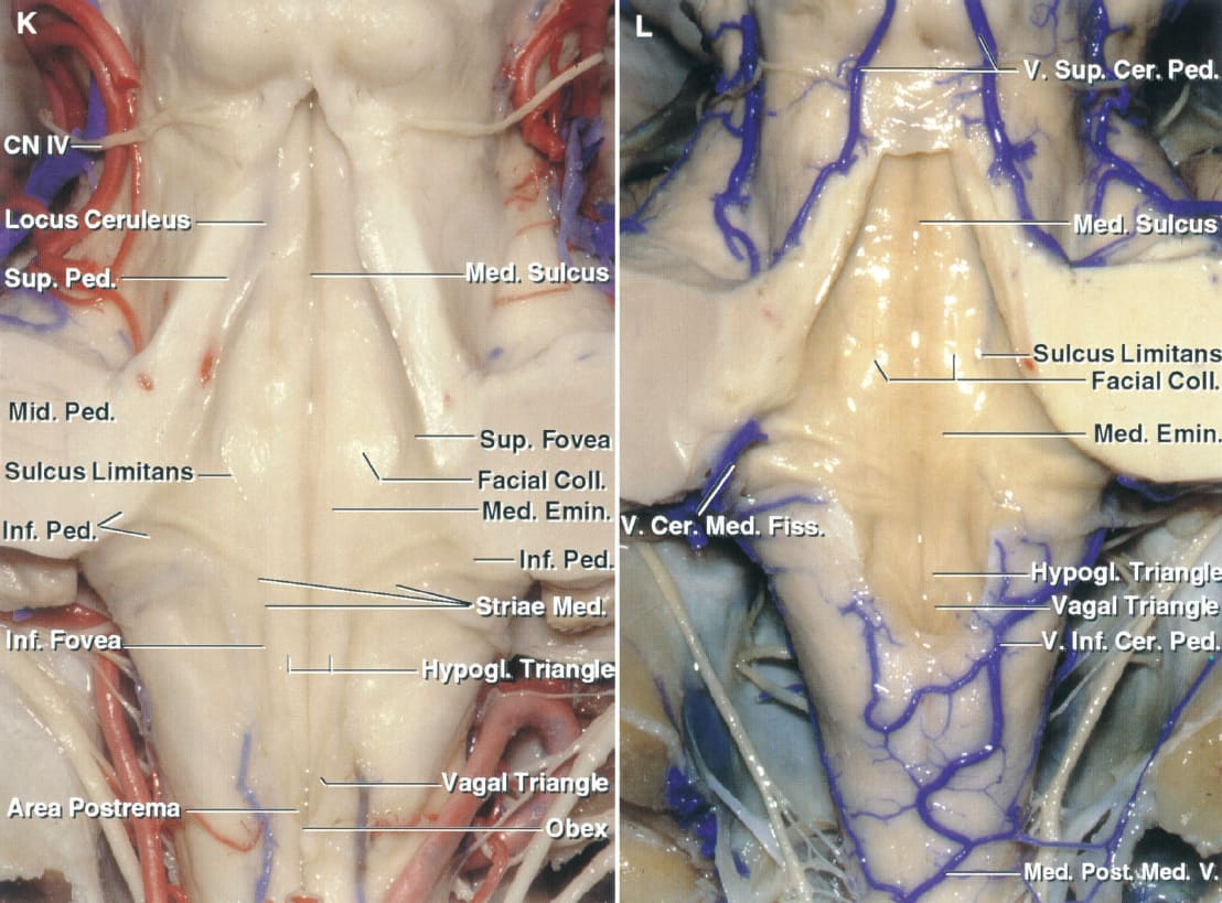 Relationships of the Inferior Medullary Velum, Dentate Nucleus, Tonsil ...