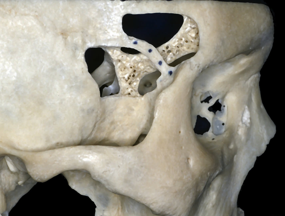 Right Lateral View of Skull | Neuroanatomy | The Neurosurgical Atlas