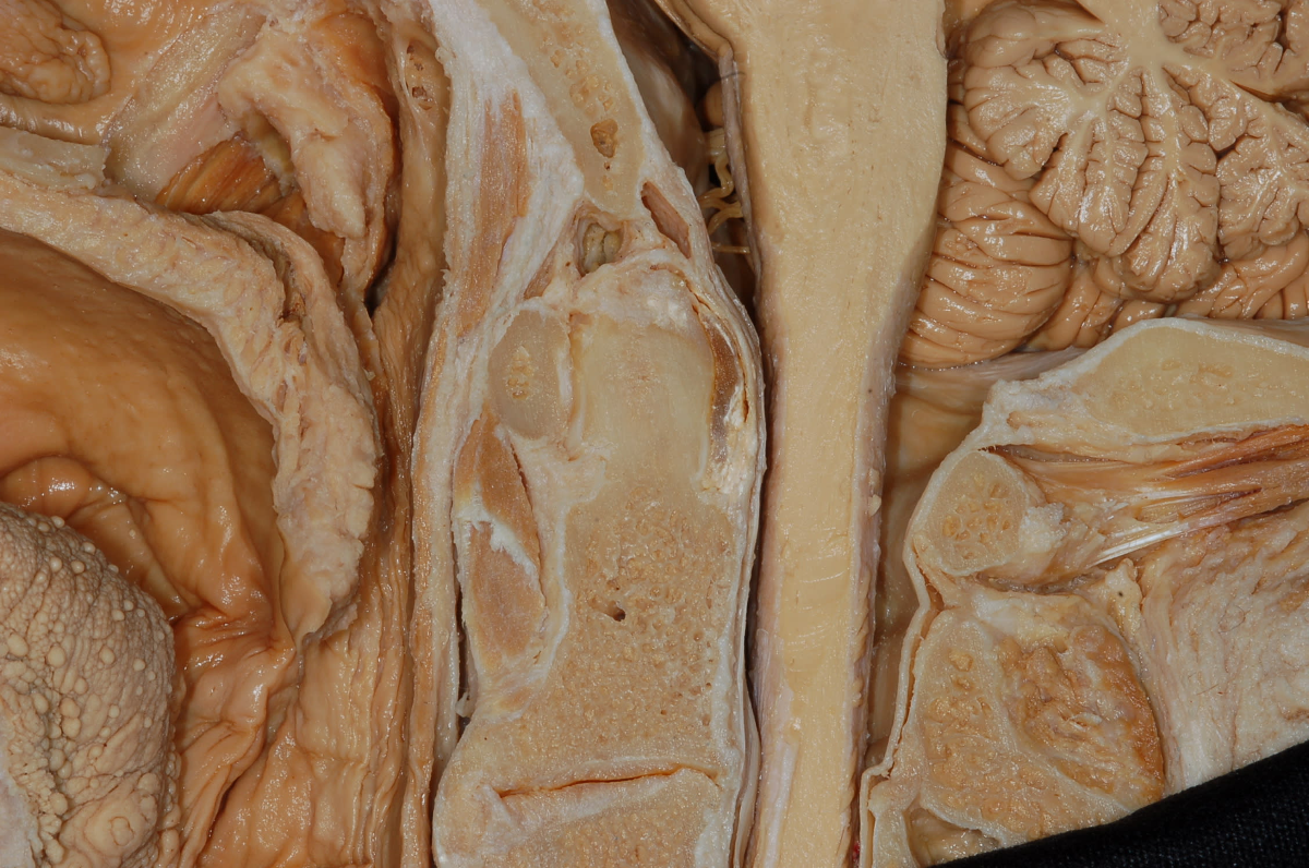 Sagittal View of the Head at the Level of Foramen Magnum | Neuroanatomy ...