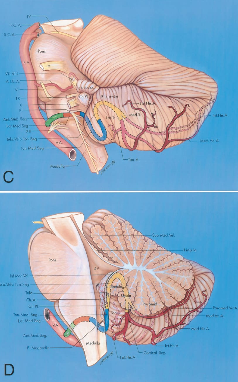 Segments of the Posterior Inferior Cerebellar Artery | Neuroanatomy ...