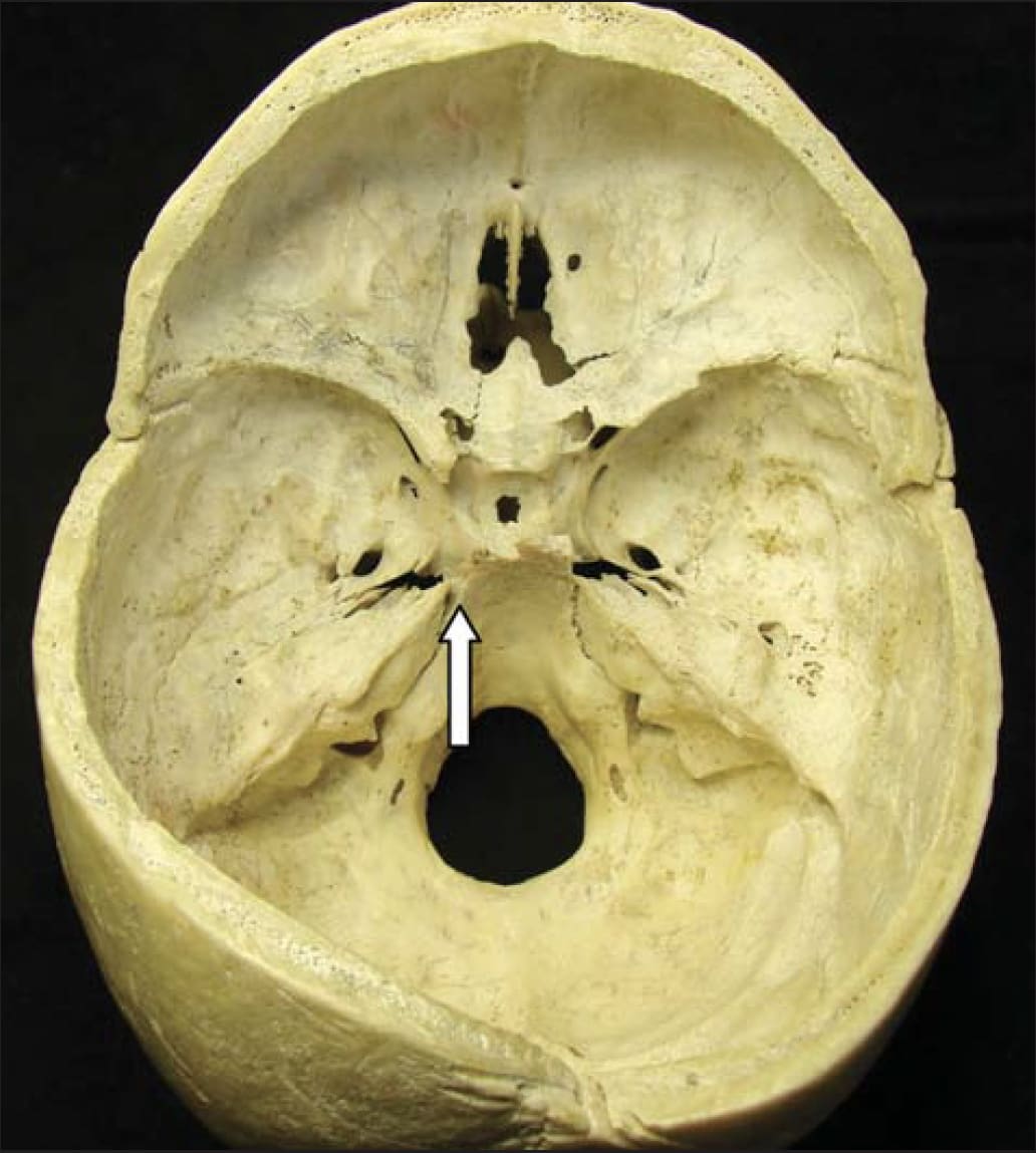 Superior View of the Skull Base | Neuroanatomy | The Neurosurgical Atlas