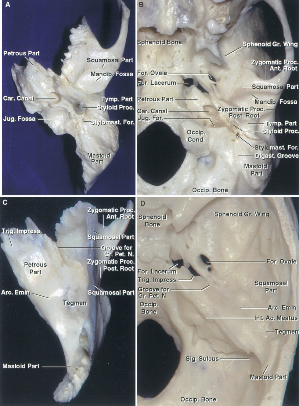 Temporal Bone | Neuroanatomy | The Neurosurgical Atlas
