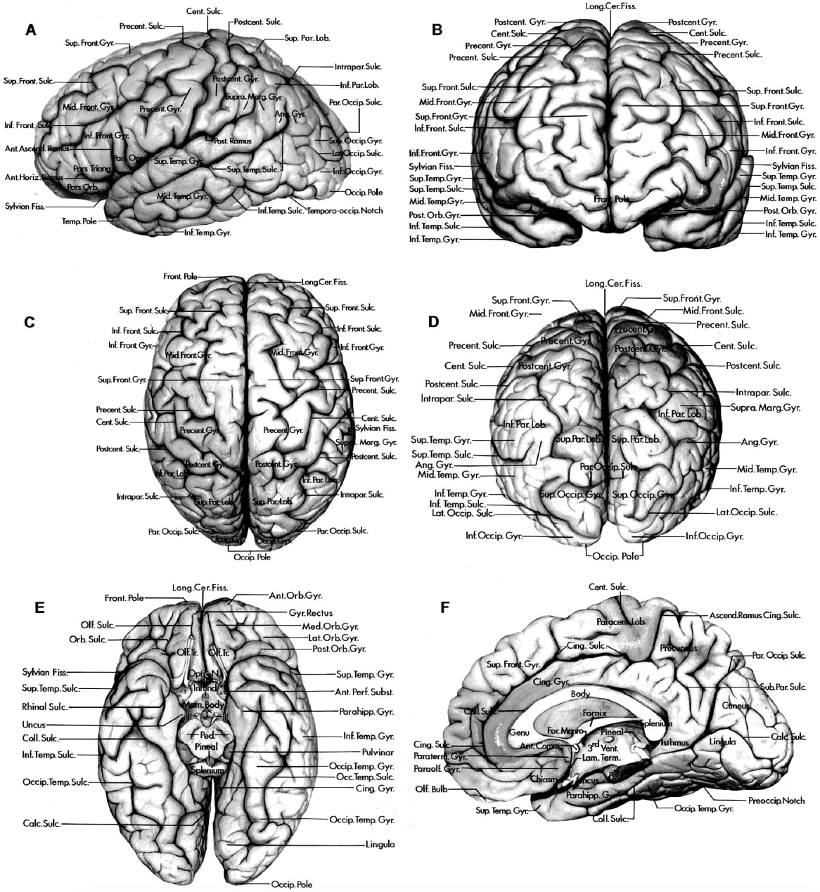 Tentorial Surface and Cerebellomesencephalic Fissure | Neuroanatomy ...