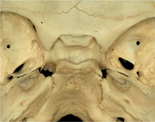 Transcranial Classification of the Clival Region | Neuroanatomy | The ...