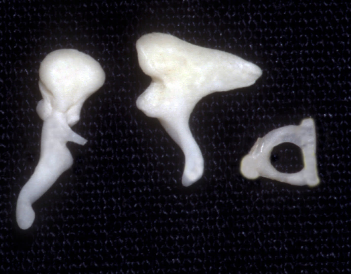 View of isolated middle ear Ossicles | Neuroanatomy | The Neurosurgical ...