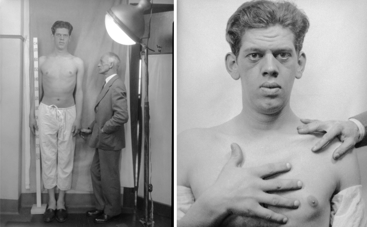 Microscope-Guided Endonasal Transsphenoidal Approach | Cohen Collection ...