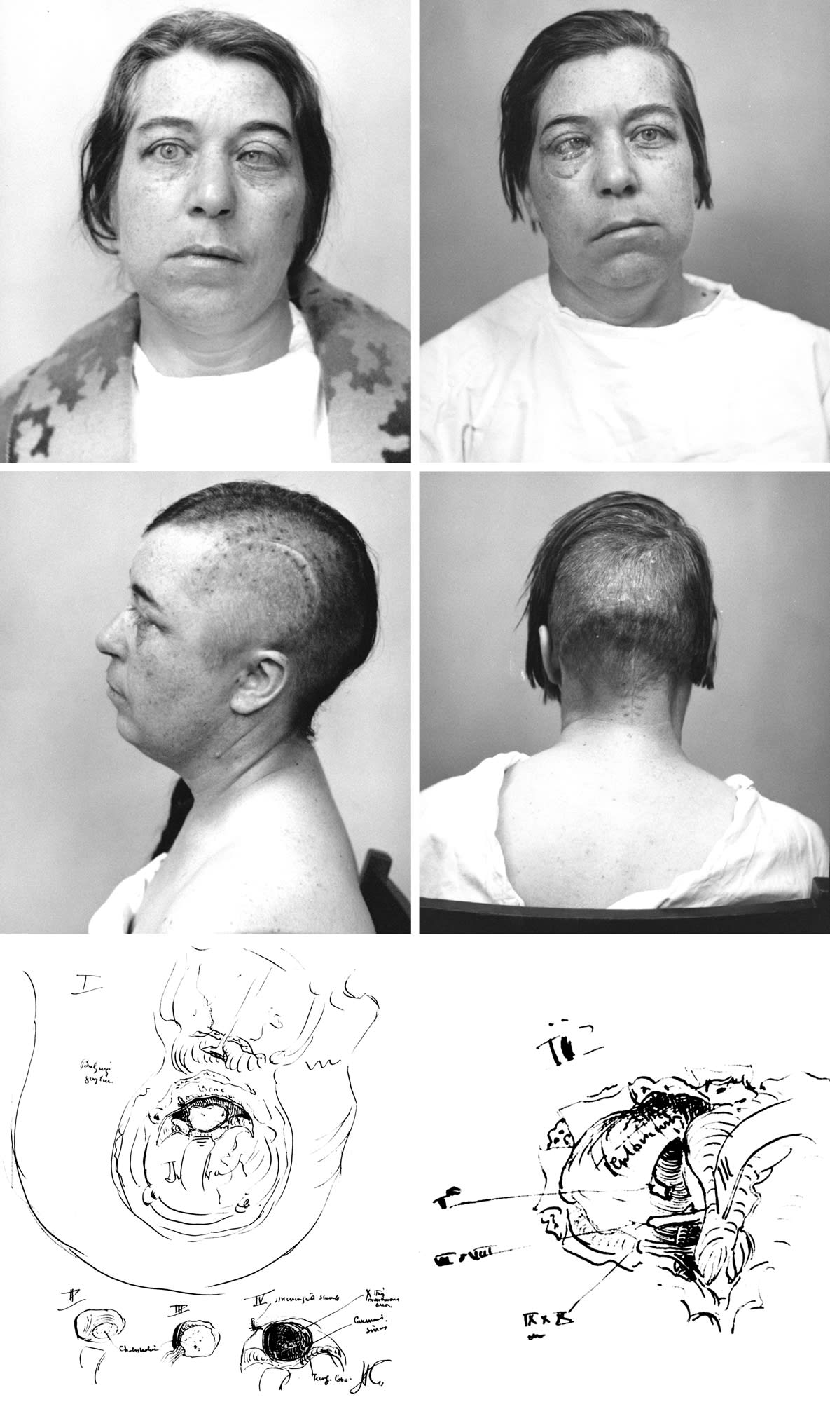 Preoperative Considerations, Instrumentation and Patient Positioning ...