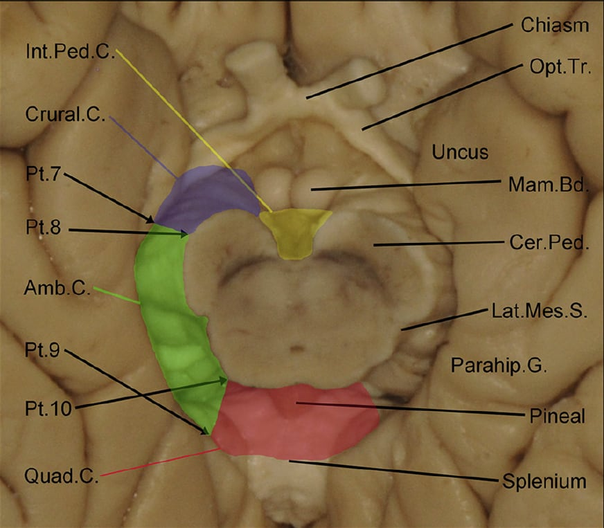 Ambient Cistern | Cohen Collection | Volumes | The Neurosurgical Atlas